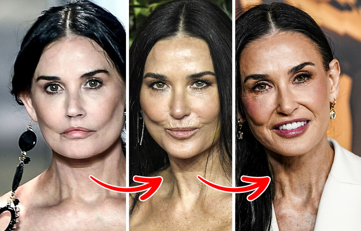 Experts Uncover What Really Changed Demi Moore’s Face