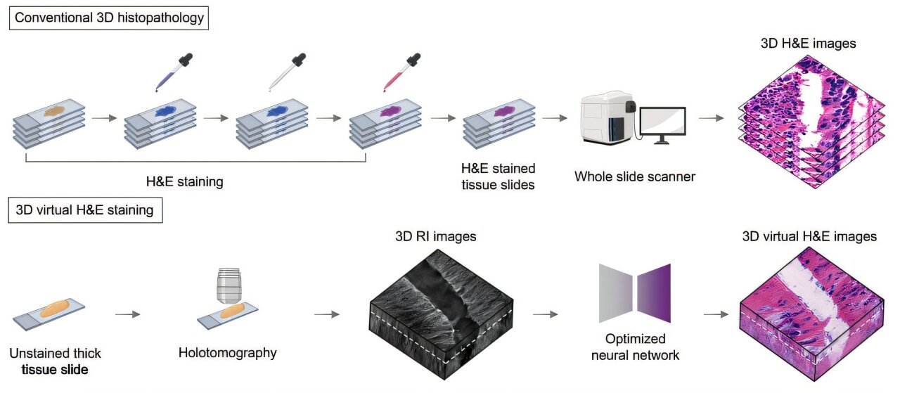 3D virtual staining technology enables non-invasive observation of cancer tissue
