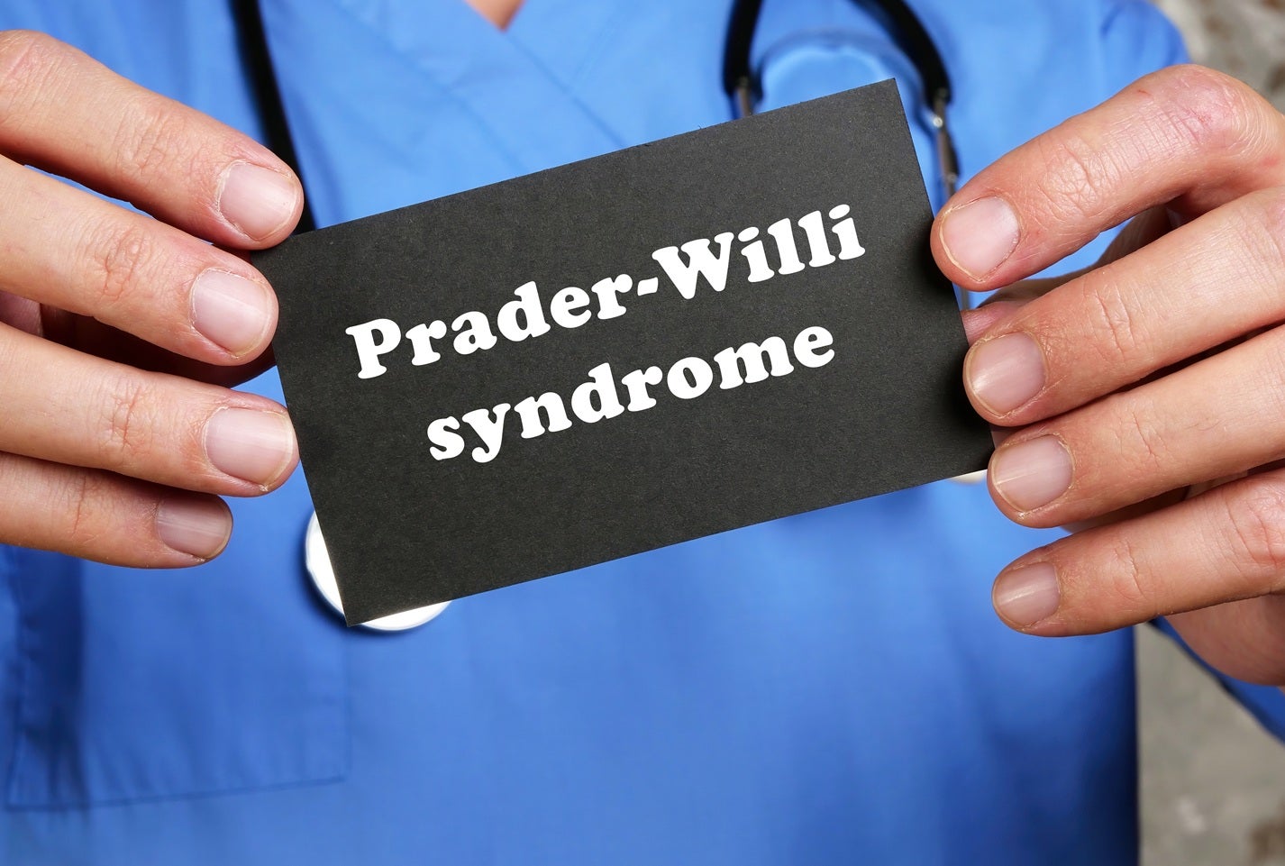 EMA validates Soleno’s application for Prader-Willi syndrome treatment