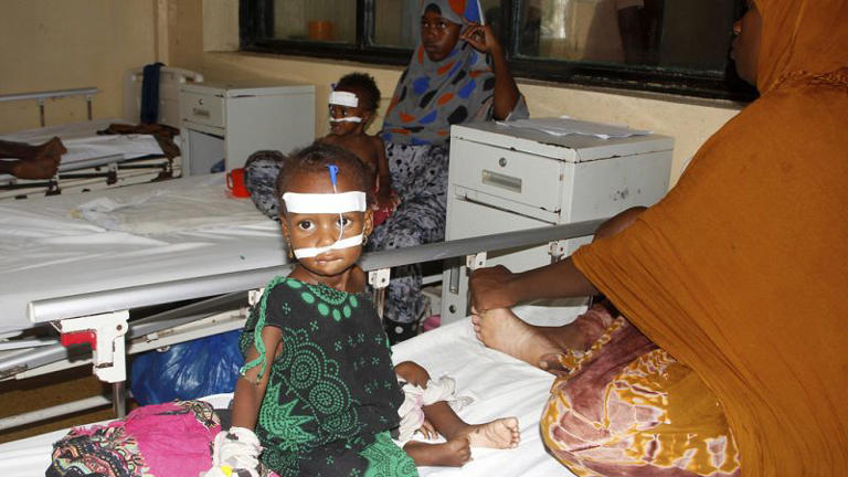 Somali families devastated as child hunger worsens amid aid cuts