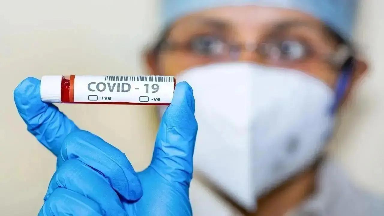 Covid-19: Current virus strain not serious, but precautions necessary