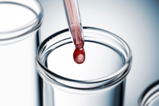 Tempo de protrombina: o que é, para que serve o exame e valores