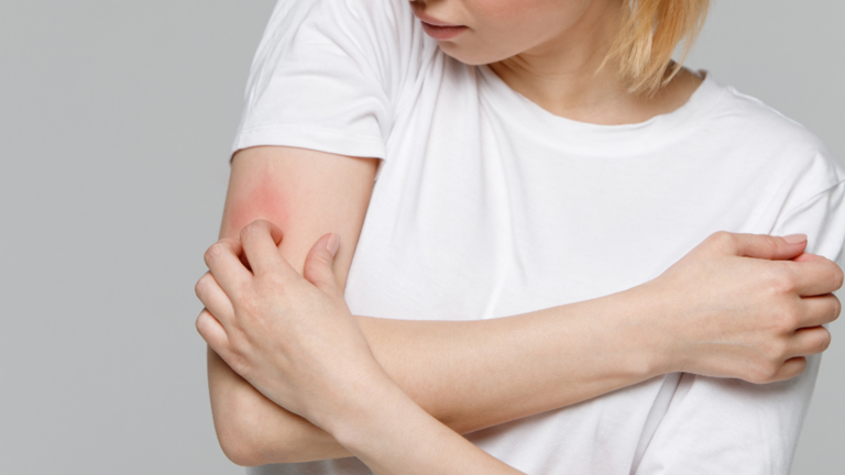 Déze symptomen kunnen wijzen op smetplekken: 9 tips om ze te behandelen