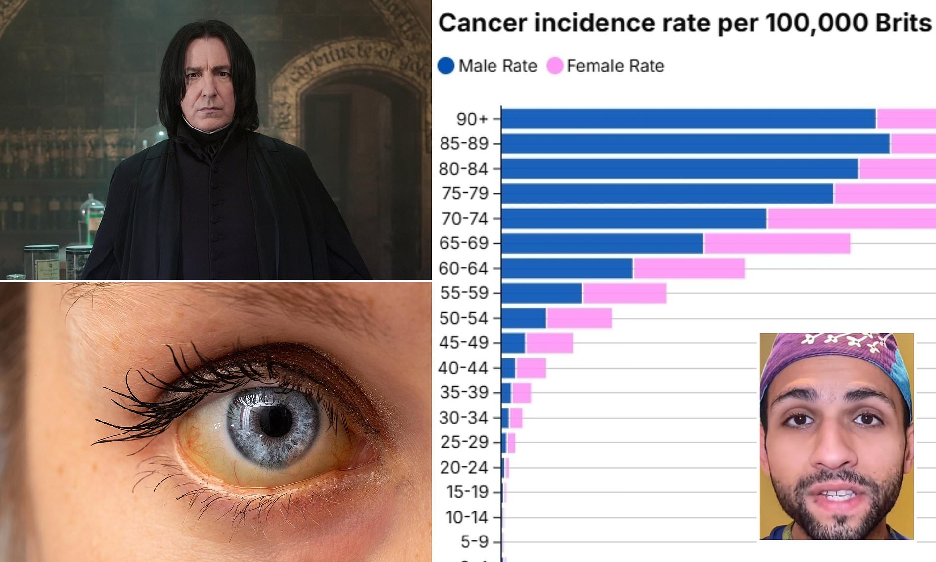 I'm a cancer surgeon - everyone must learn the three subtle signs of ...