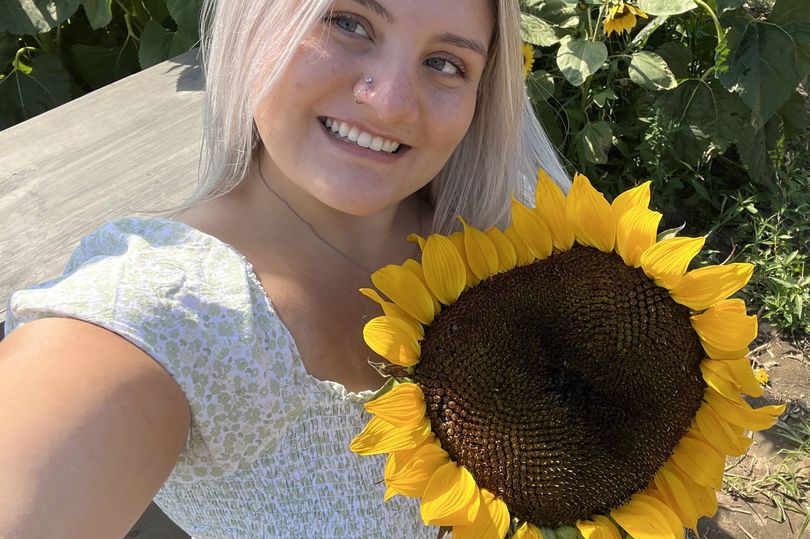 Woman's holiday 'sunburn' makes her face so swollen her mum doesn't ...