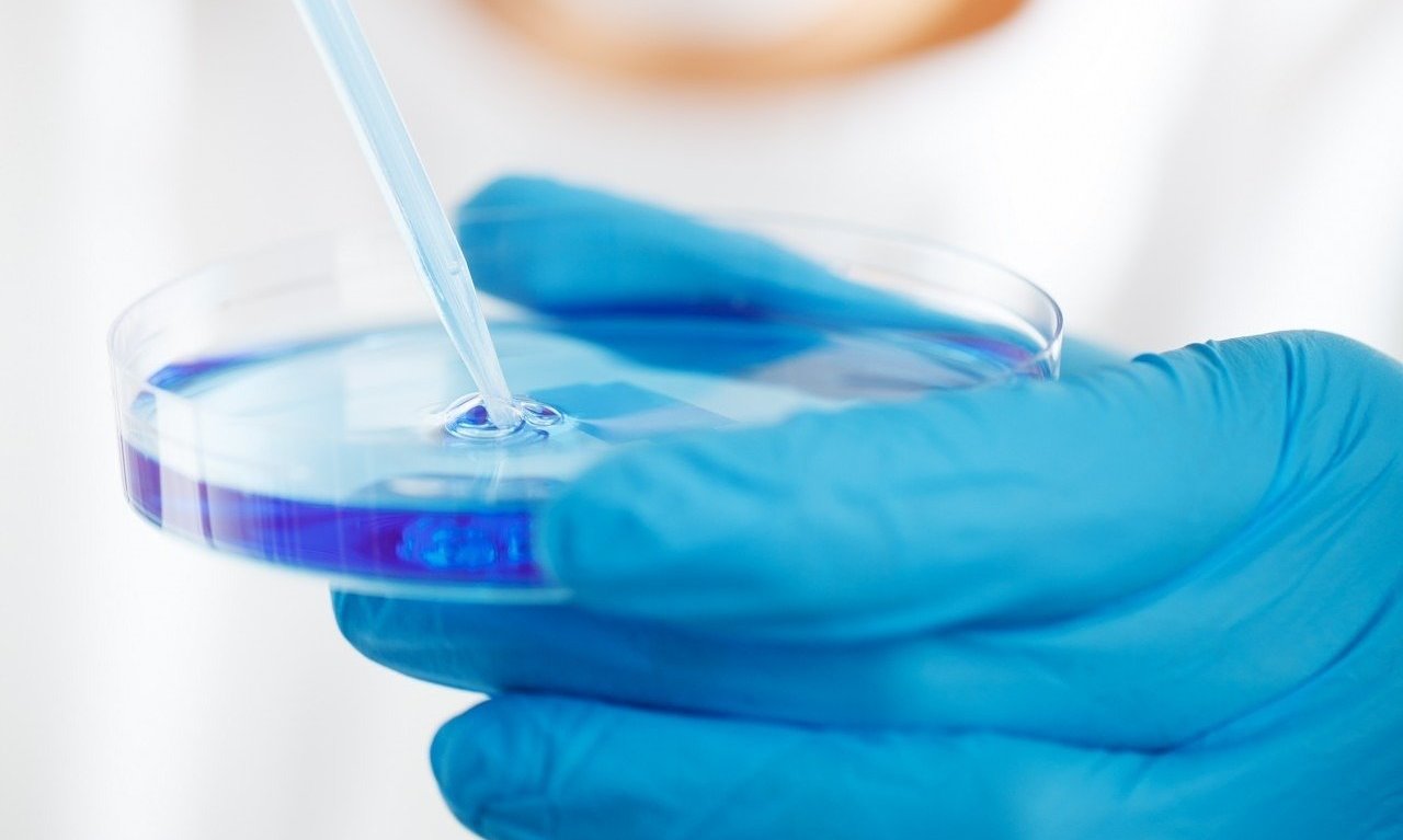 Preventing the next pandemic: One Health researcher calls for urgent action