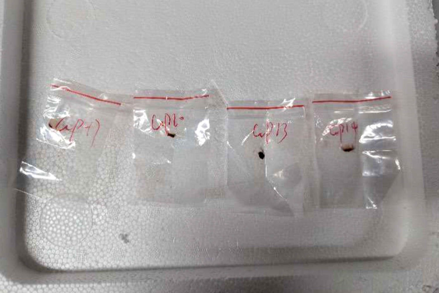 Chinese couple charged with smuggling a biological pathogen into the U.S.