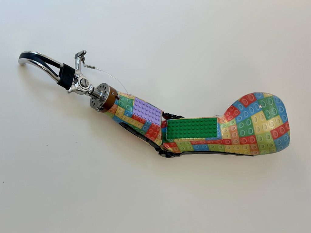 Young Lego fan given prosthetic arm built using real Lego