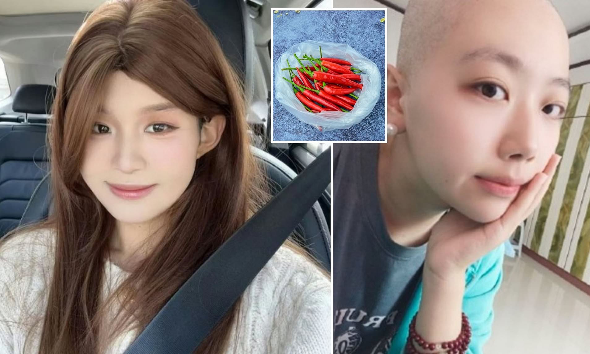 Doctor issues warning over spicy food after influencer dies of stomach ...