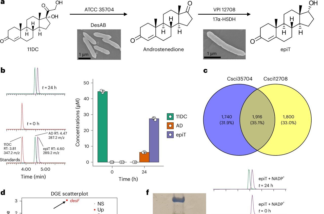 Urinary bacteria may help prostate cancer thrive through hormone changes