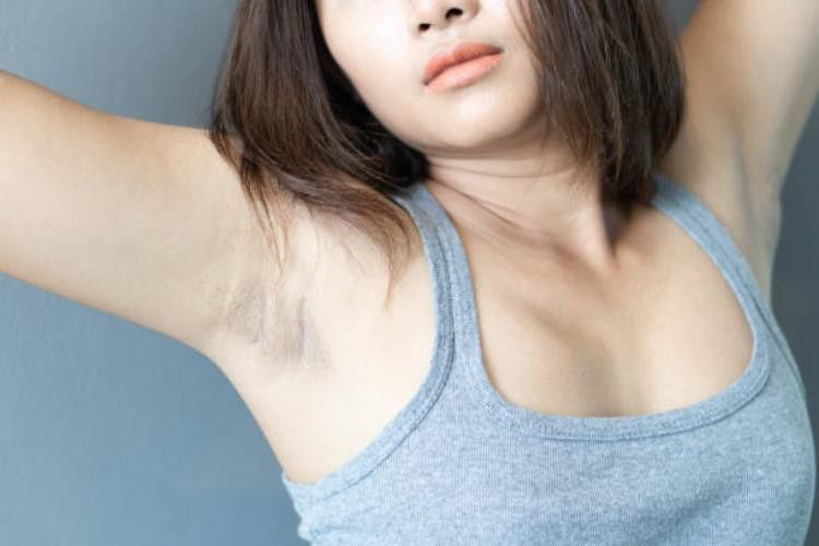 Cara Ampuh Mencerahkan Ketiak Hitam Karena Daki, Simak dan Ikuti