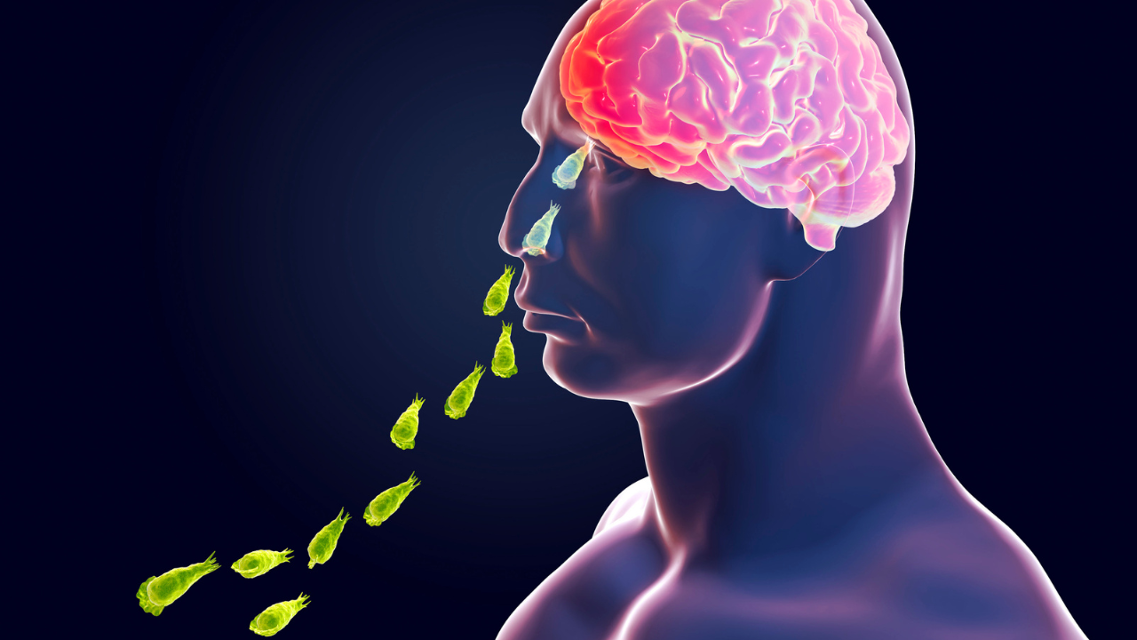 Texas Woman Dies After Sinus Rinse with Tap Water: Could This Brain ...