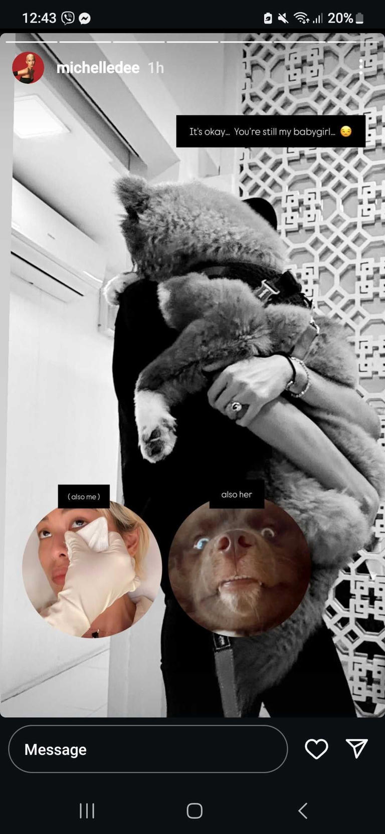 Michelle Dee gets bitten by pet dog: ‘Never underestimate dog bites!’