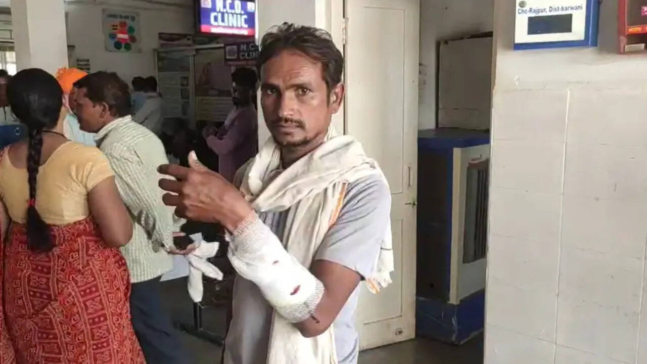 In MP Village, 17 People Bit By Mysterious Animal In 3 Hours, Forest ...