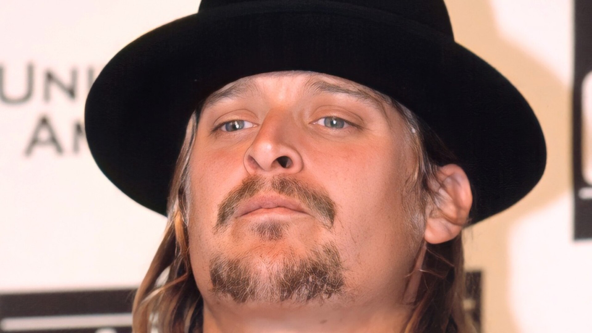 Kid Rock's Transformation Has Our Jaws On The Floor