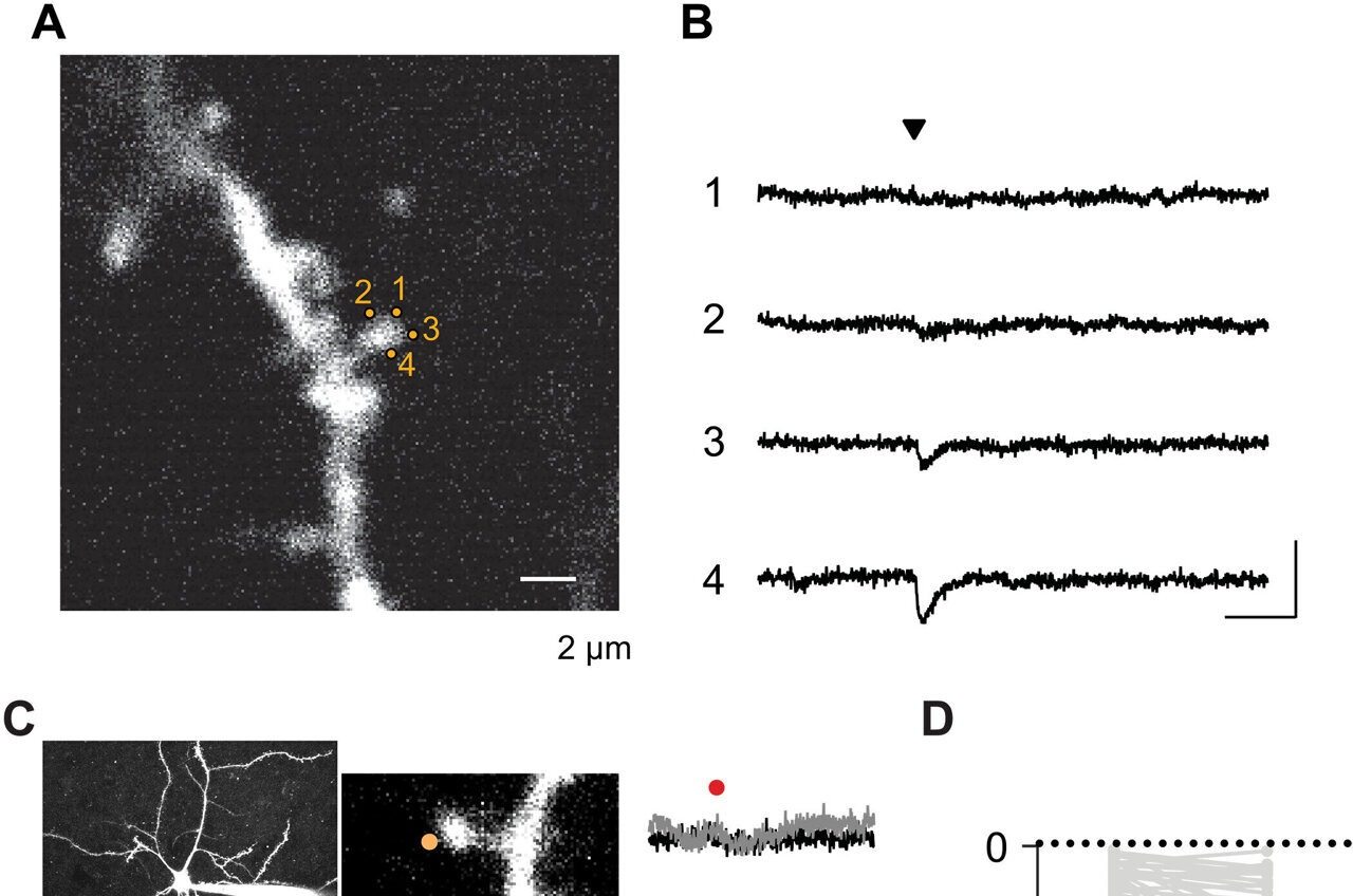 Distinct transmission sites upend decades-old assumptions about brain ...