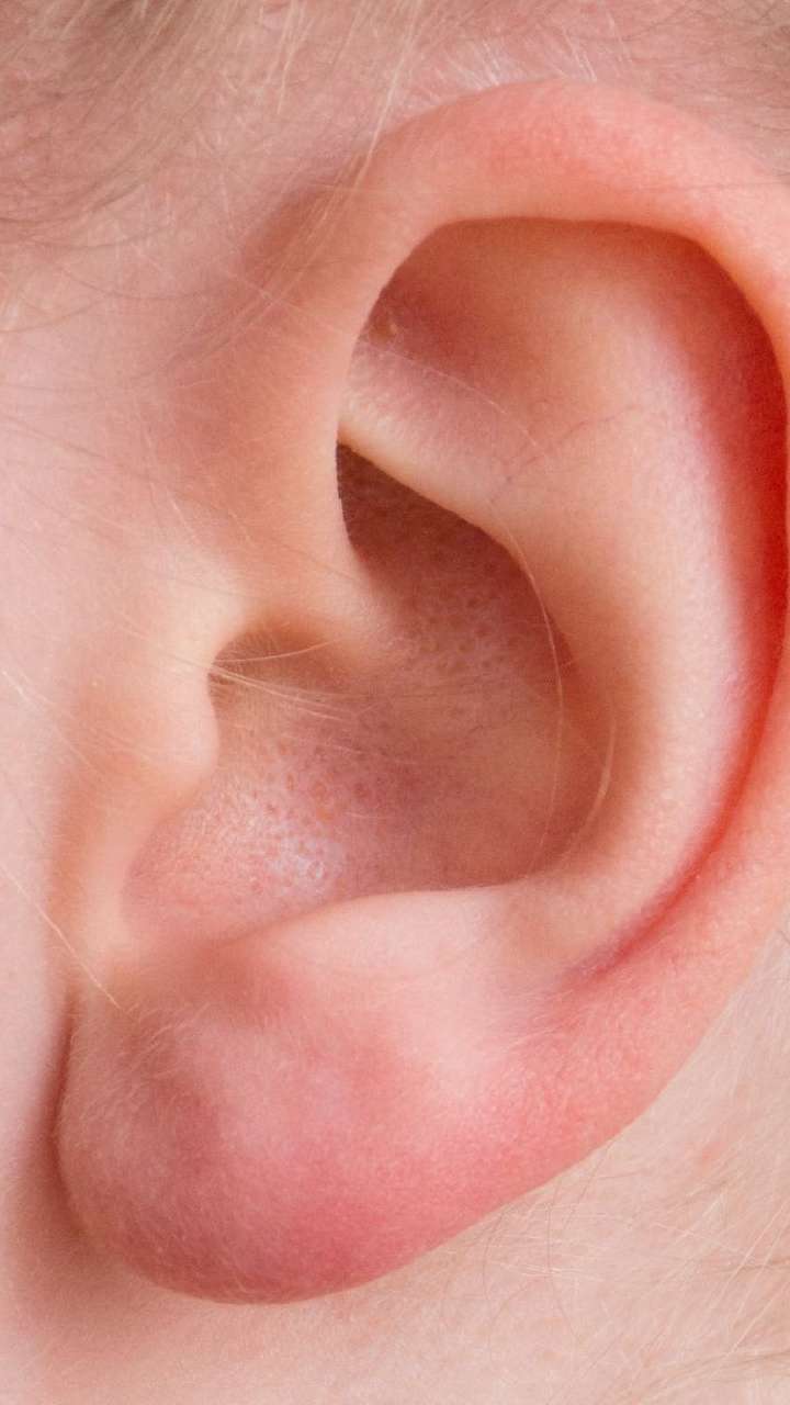 Why Do Our Ears Become Oily