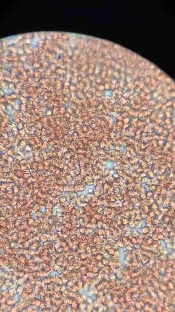 What Blood Looks Like Under the Microscope