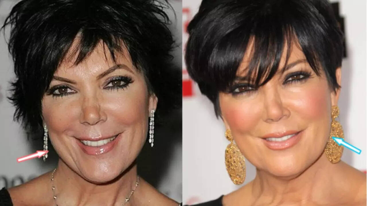 Meet Garth Fisher, the plastic surgeon the Kardashians can’t keep calm ...