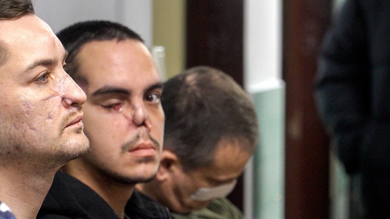 Rebuilding the faces of Ukraine’s war