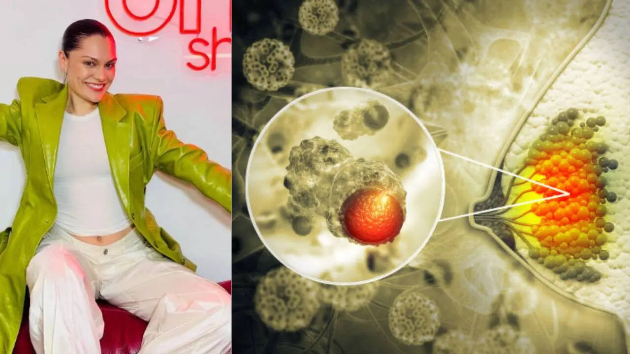 5 Biggest Triggers of Breast Cancer, According to Experts