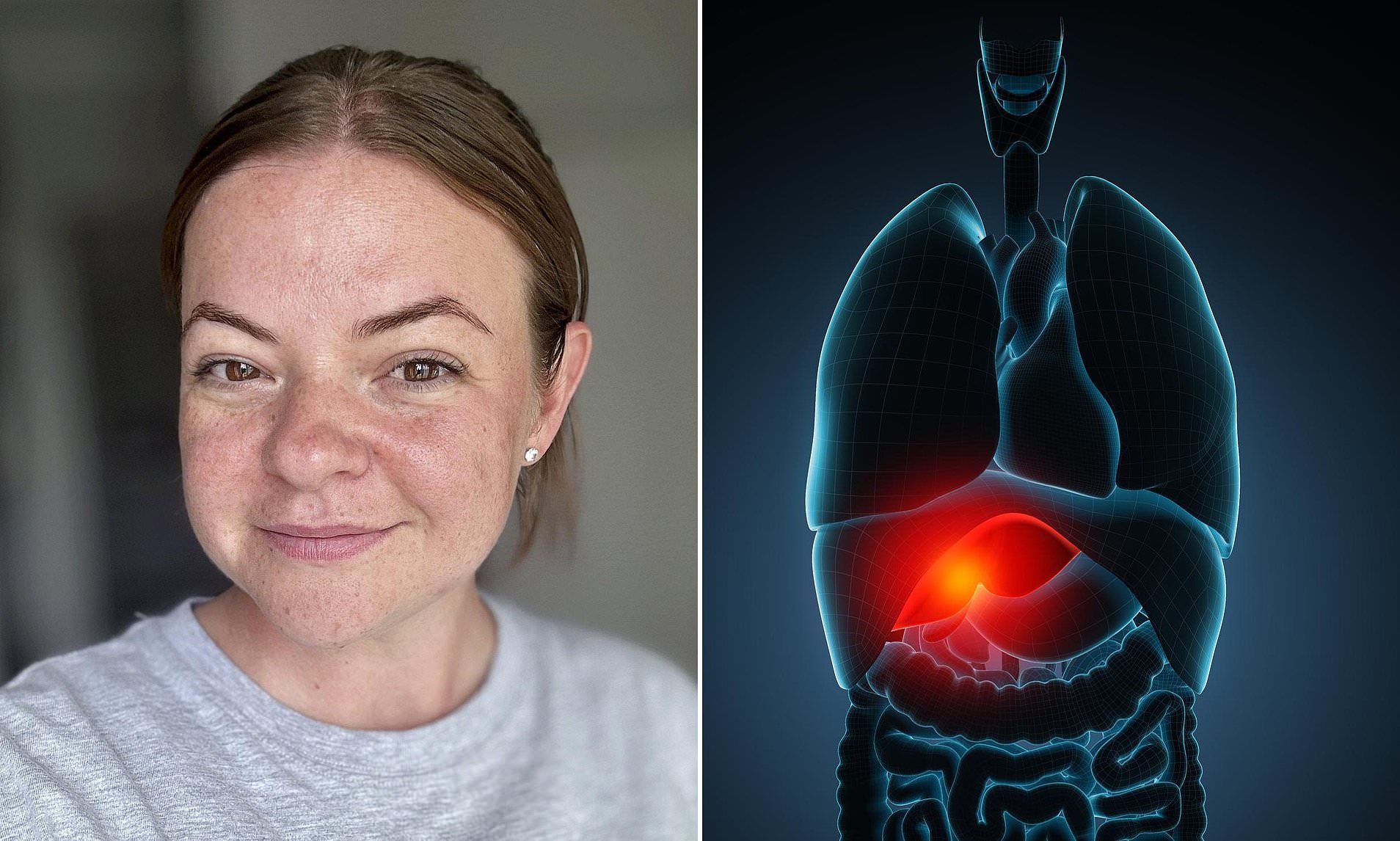 Warning over popular drink after mother-of-two develops organ damage ...