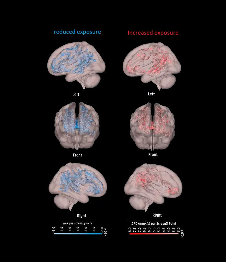Science confirms: too much screen time hurts young minds