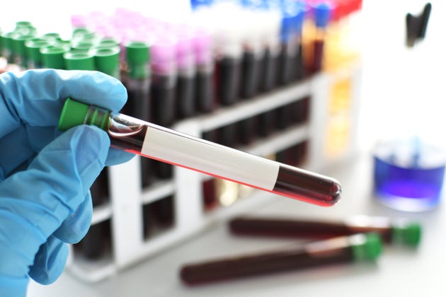Ανατρεπτική τεχνολογία mRNA «ξεσκεπάζει» τον HIV – Το πρώτο βήμα για ...