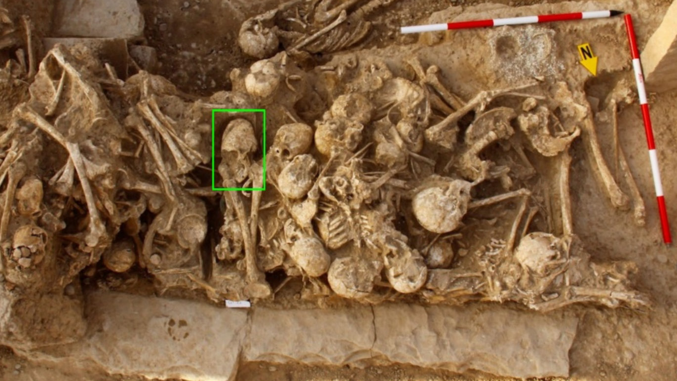 'Cone-headed' skull from Iran was bashed in 6,200 years ago, but no one ...