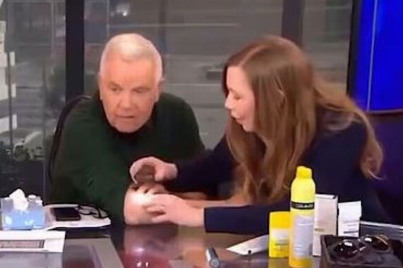 Moment Fox News host is told he has skin cancer live on air