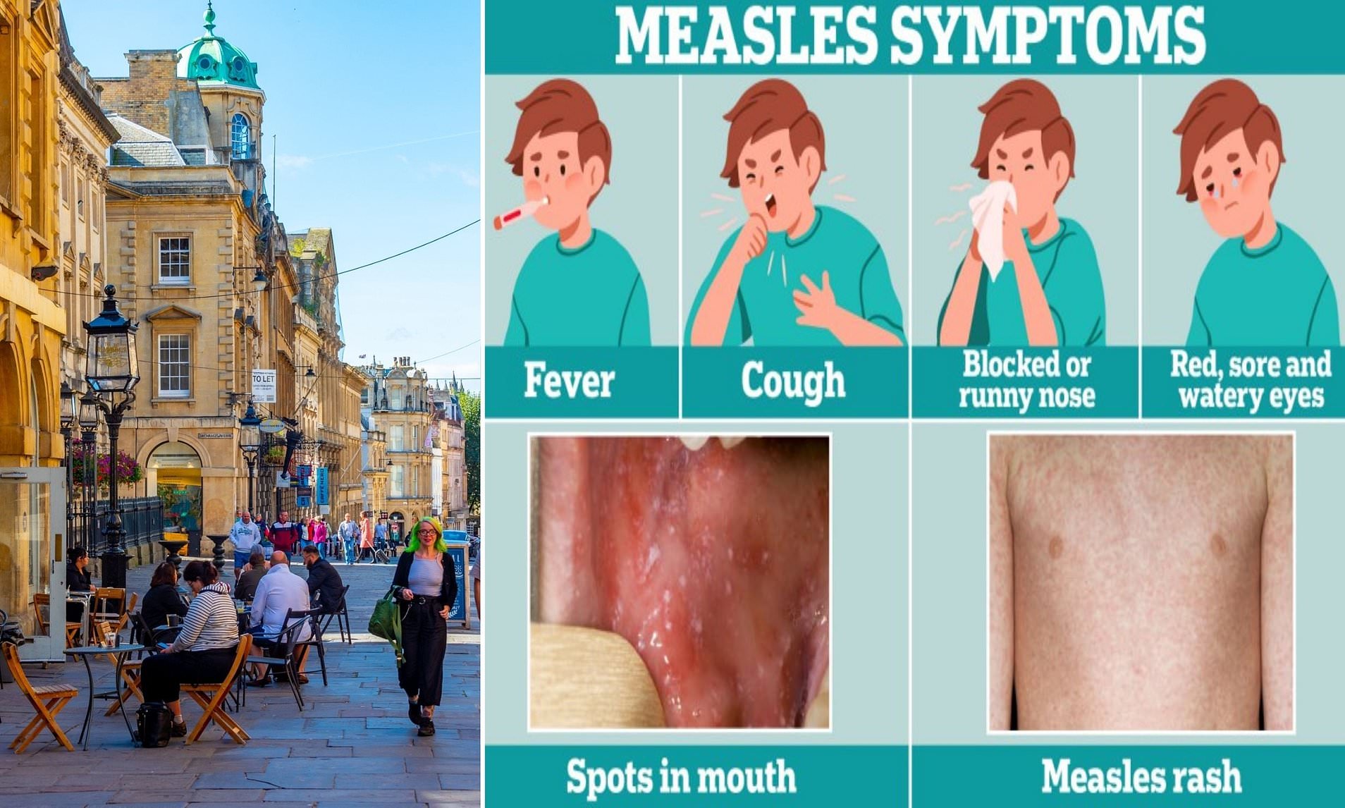 Health chiefs' urgent warning over record highs of deadly measles - are ...