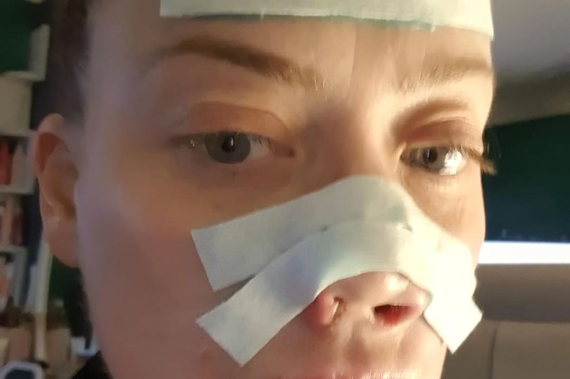 Mum's face collapses after Turkey teeth treatment in 'worst pain of life'