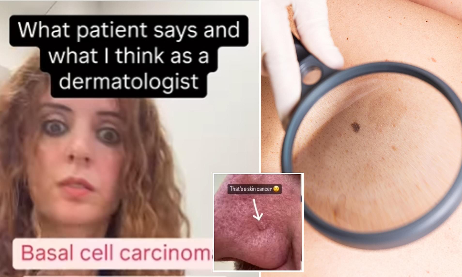 I'm a dermatologist - there's two little-known signs of skin cancer ...