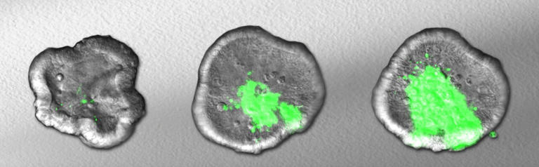 Lab-grown mini-intestines map how Shigella bacteria invade human gut tissue