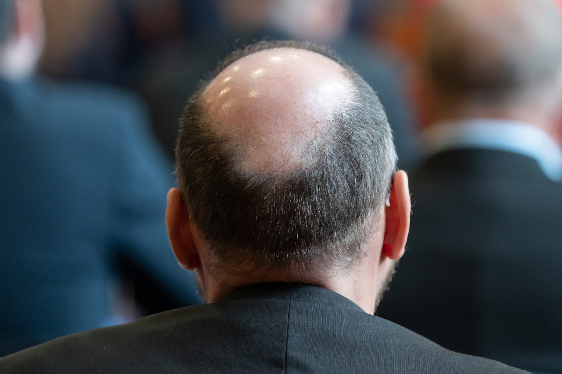 Which countries have the most bald men?