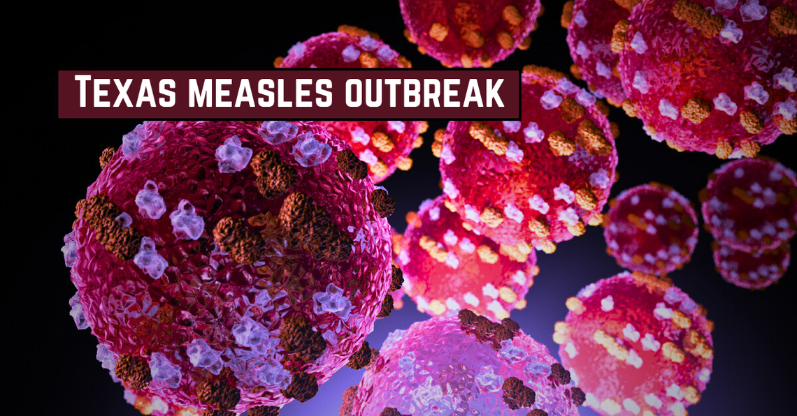 Health department reports first case of measles in Dallas County in 2025
