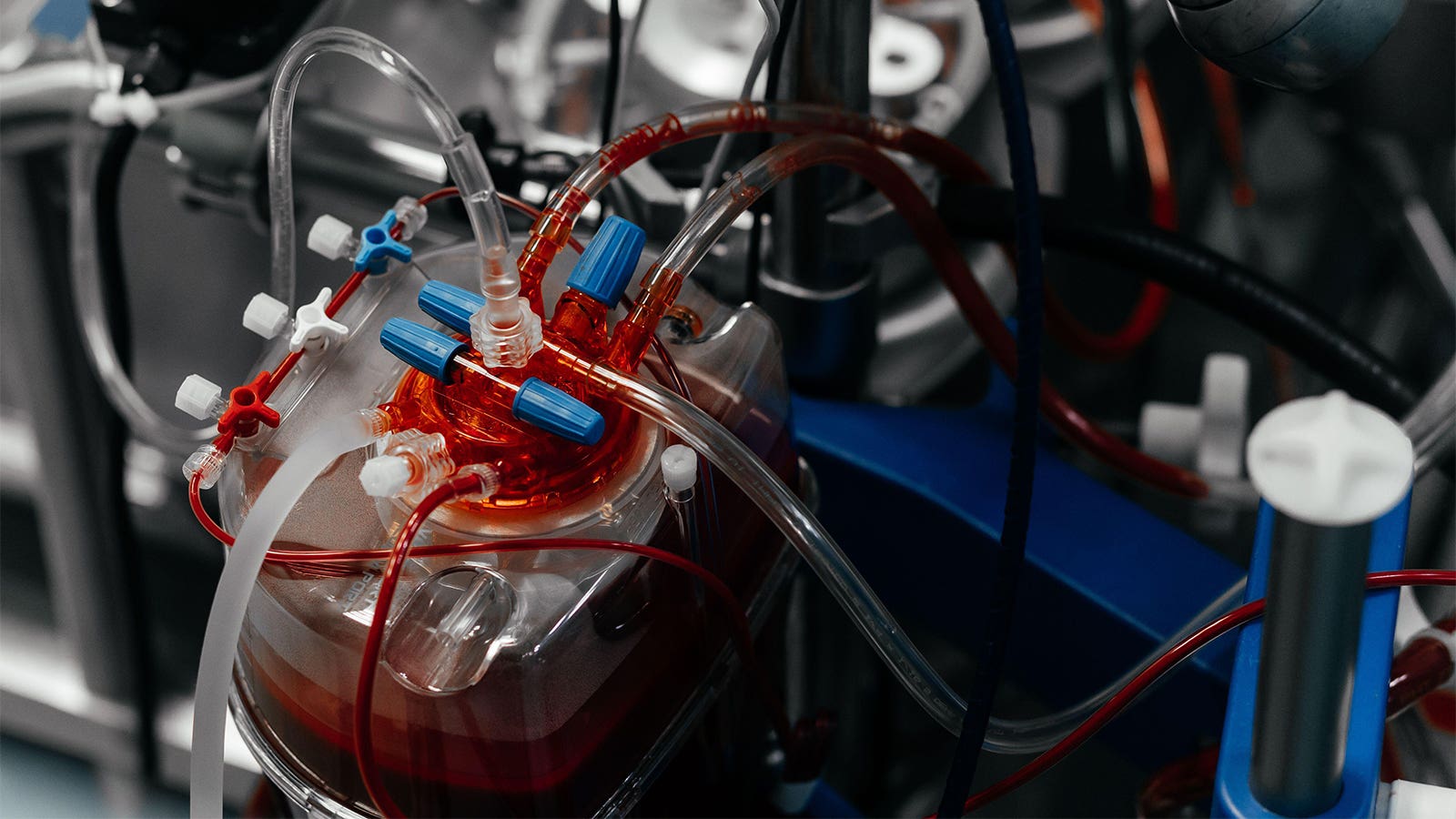 Surgical Blood Conservation Technique Falls Short in Trial