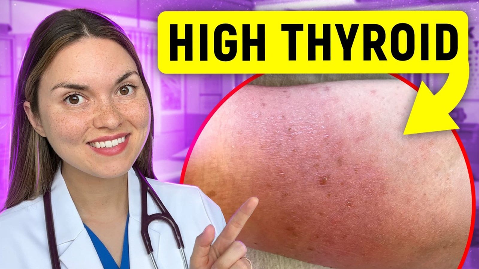 19 Signs of Hyperthyroidism You Can See: Doctor Explains