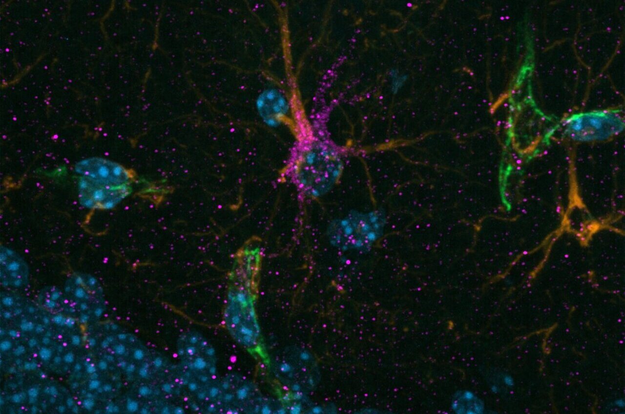 How physical activity protects the brain—cell by cell—in Alzheimer's ...