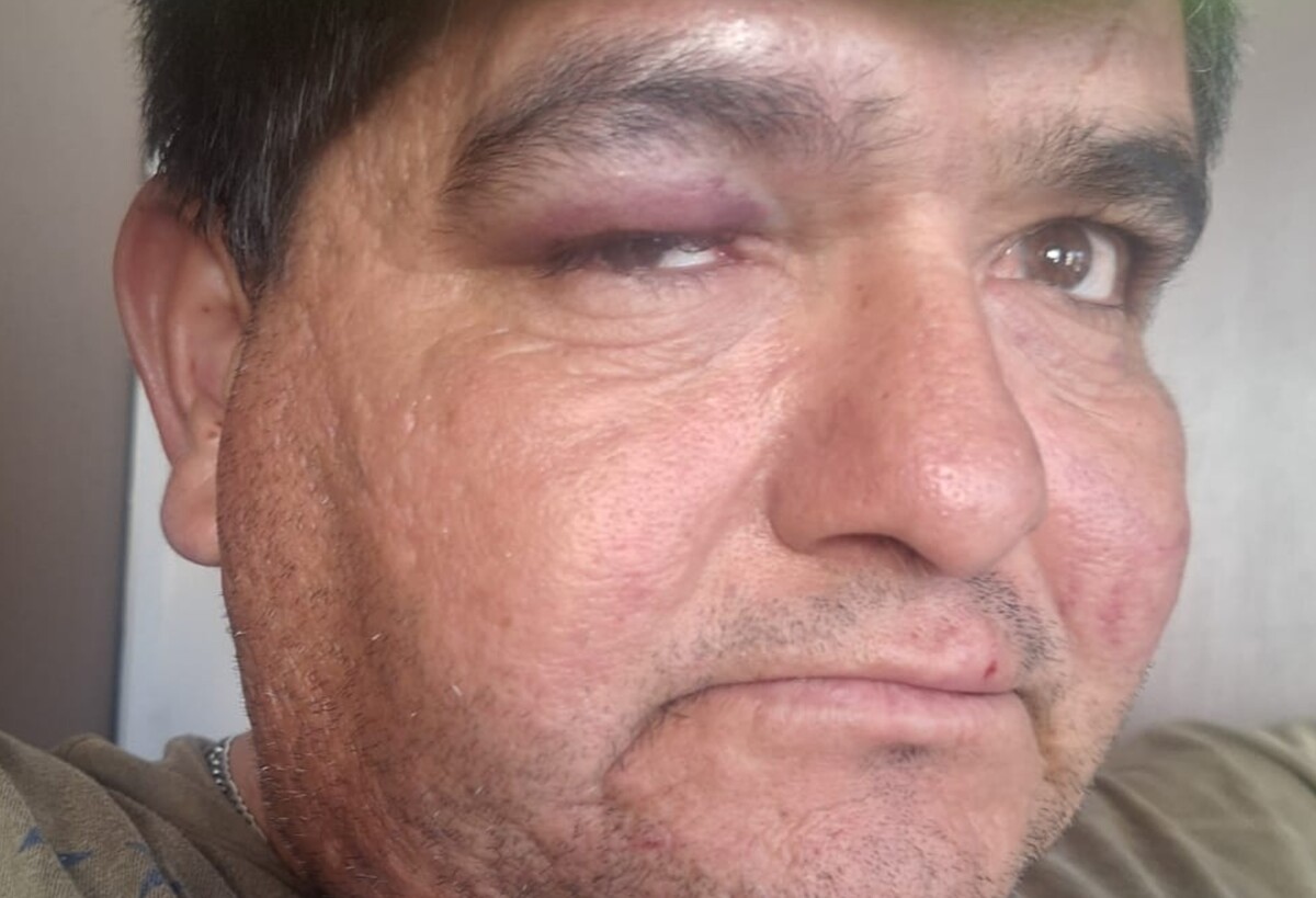 Guardia de seguridad fue golpeado salvajemente por repartidor de tienda en línea en Torreón