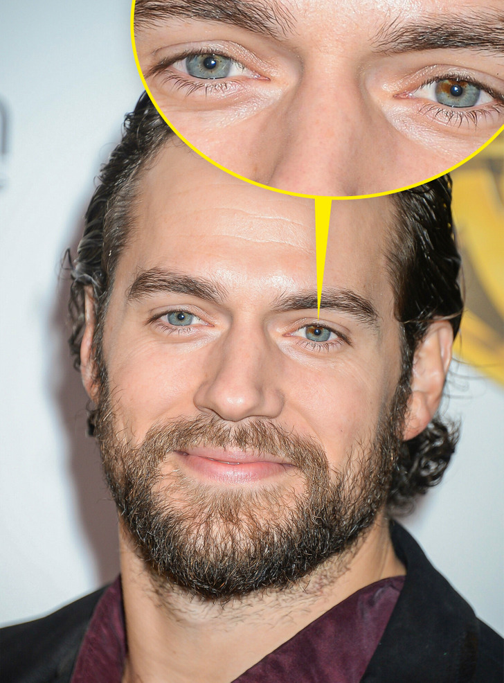 8 Celebrities Who Proudly Embrace Their Unique Features