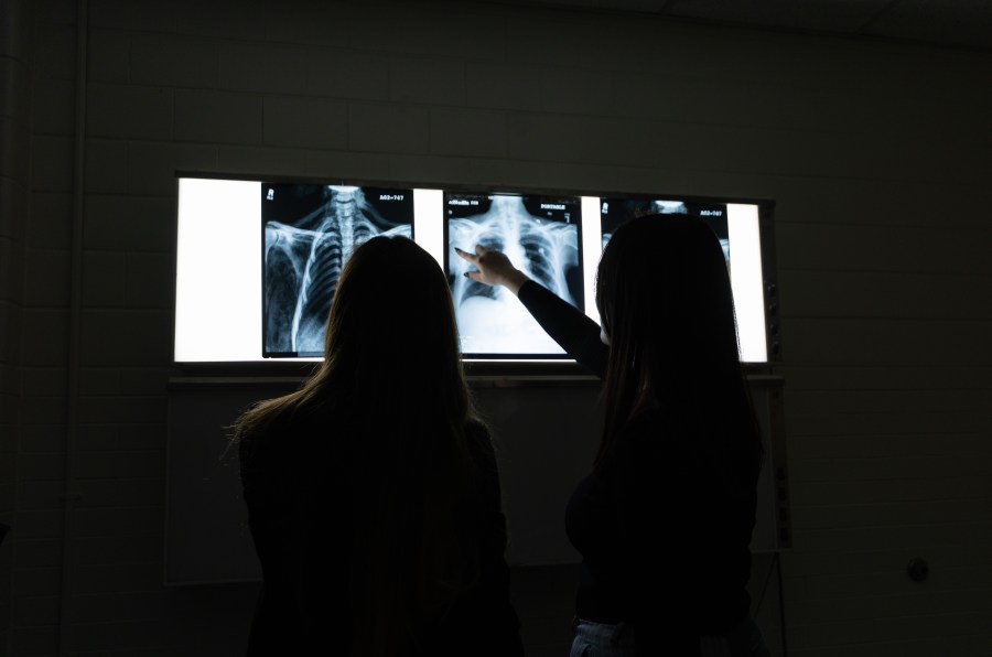 MSU forensics lab uses AI to help identify human remains