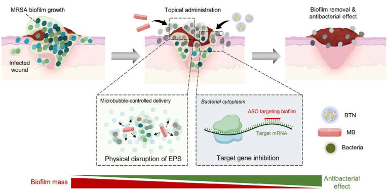 Microbubble-driven nanoparticles deliver gene suppressors to break down MRSA biofilms