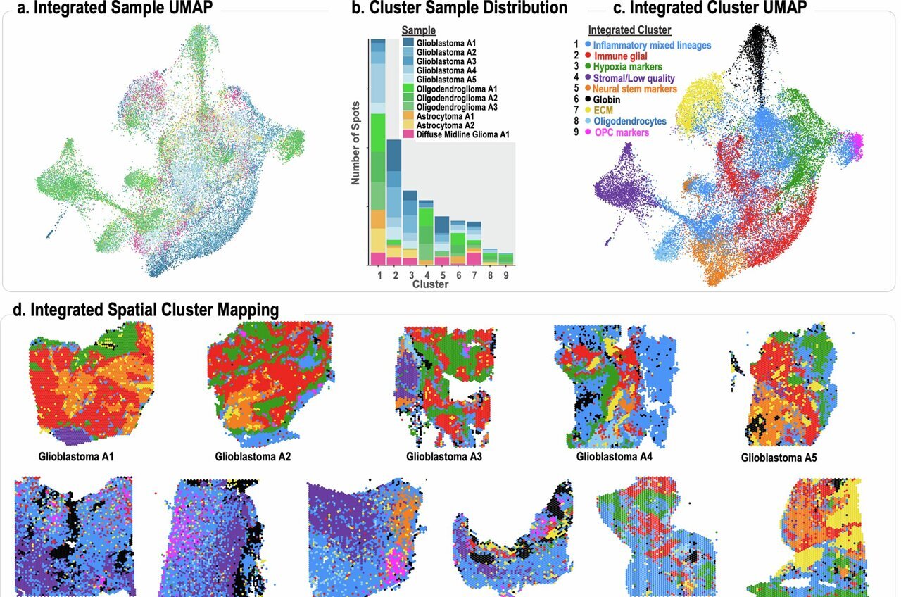 Scientists develop a foundational map of tumor cells for personalized ...
