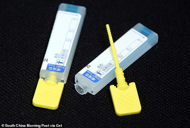 Scientists pinpoint way to check if you're going to get early-onset ...