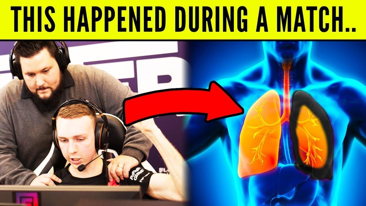10 Insane Video Game Injuries That Actually Happened To Gamers | Chaos