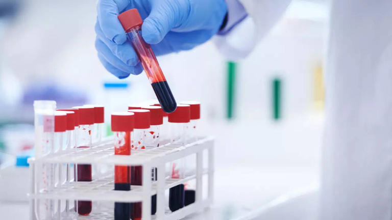 7 blood tests that can detect cancer in men and women