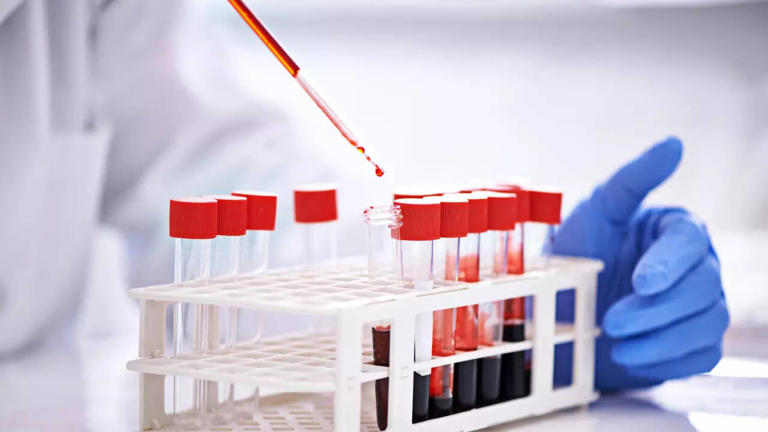 7 blood tests that can detect cancer in men and women