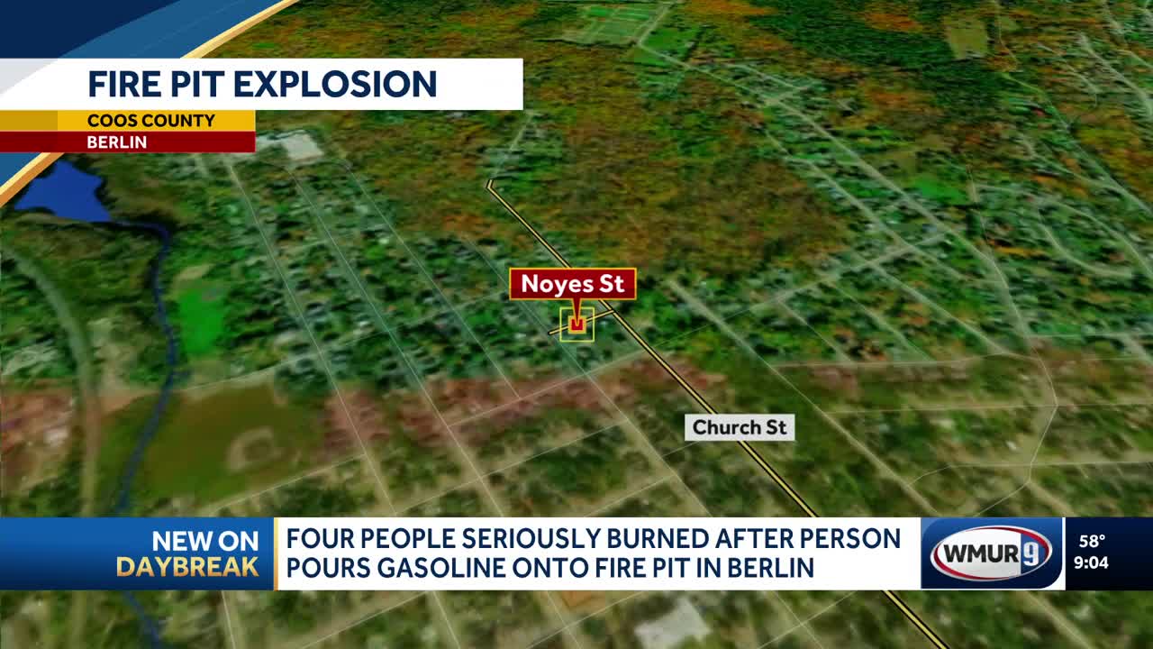 Four people seriously burned after person pours gasoline onto fire pit ...