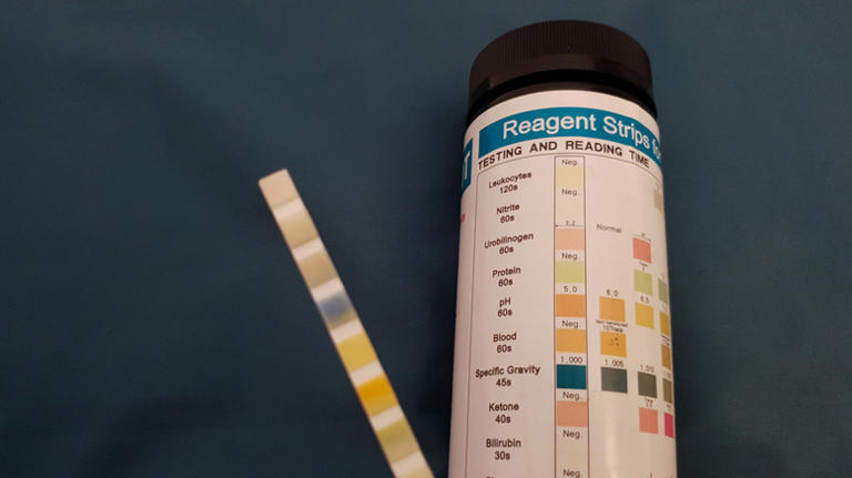 The Diabetes Complication That Can Ultimately Lead To Death If Left ...